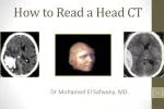 PPT - Introduction to Head CT Imaging PowerPoint Presentation, free ...