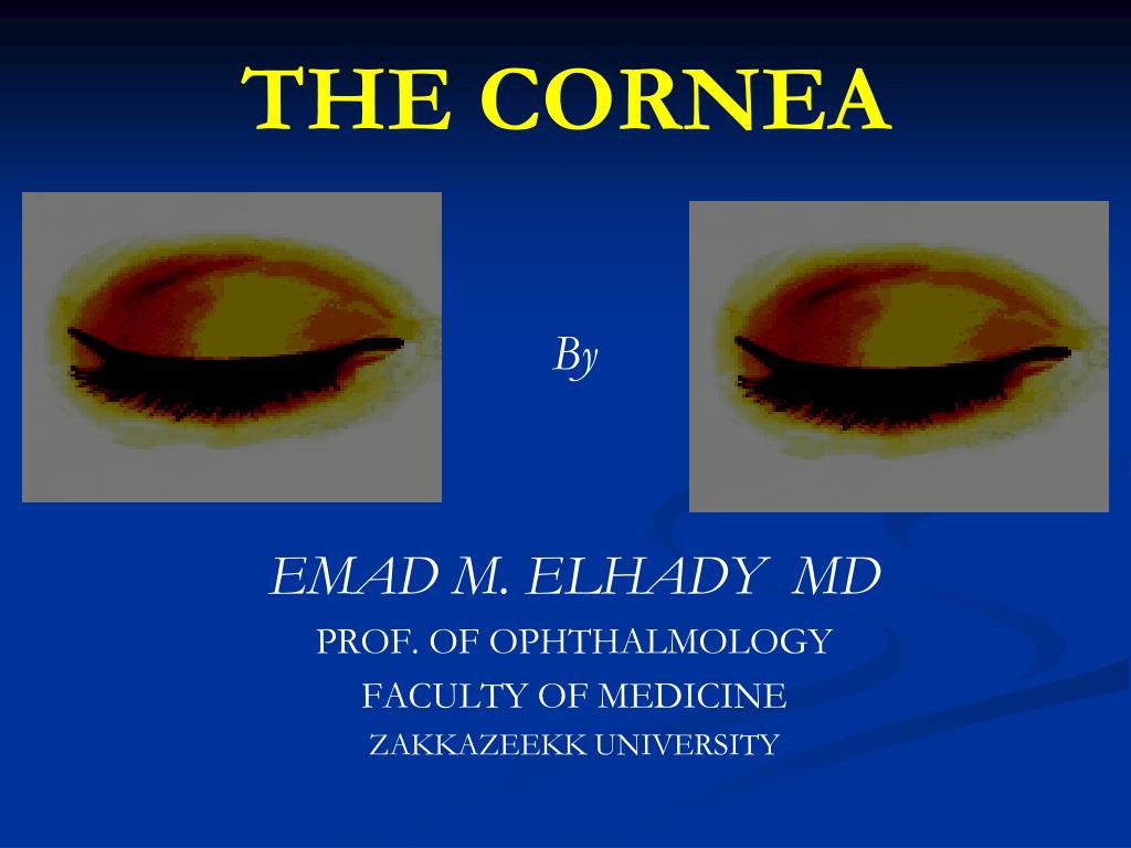 PPT - THE CORNEA PowerPoint Presentation, free download - ID:4800497