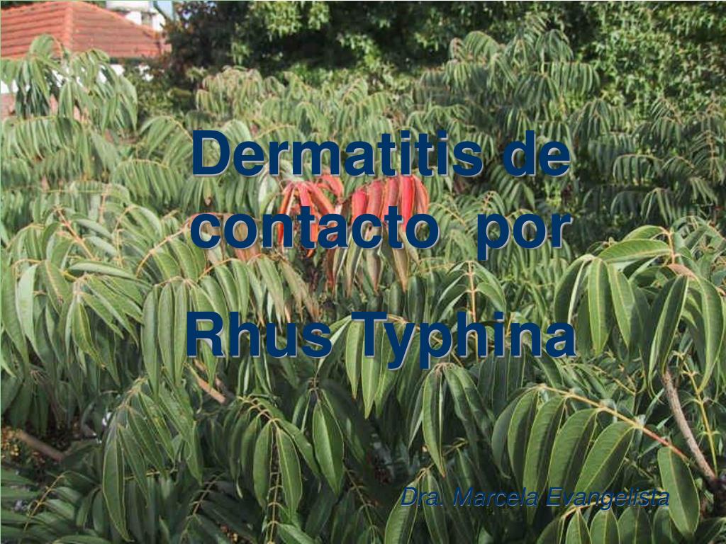 PPT - Dermatitis de contacto por Rhus Typhina PowerPoint Presentation ...