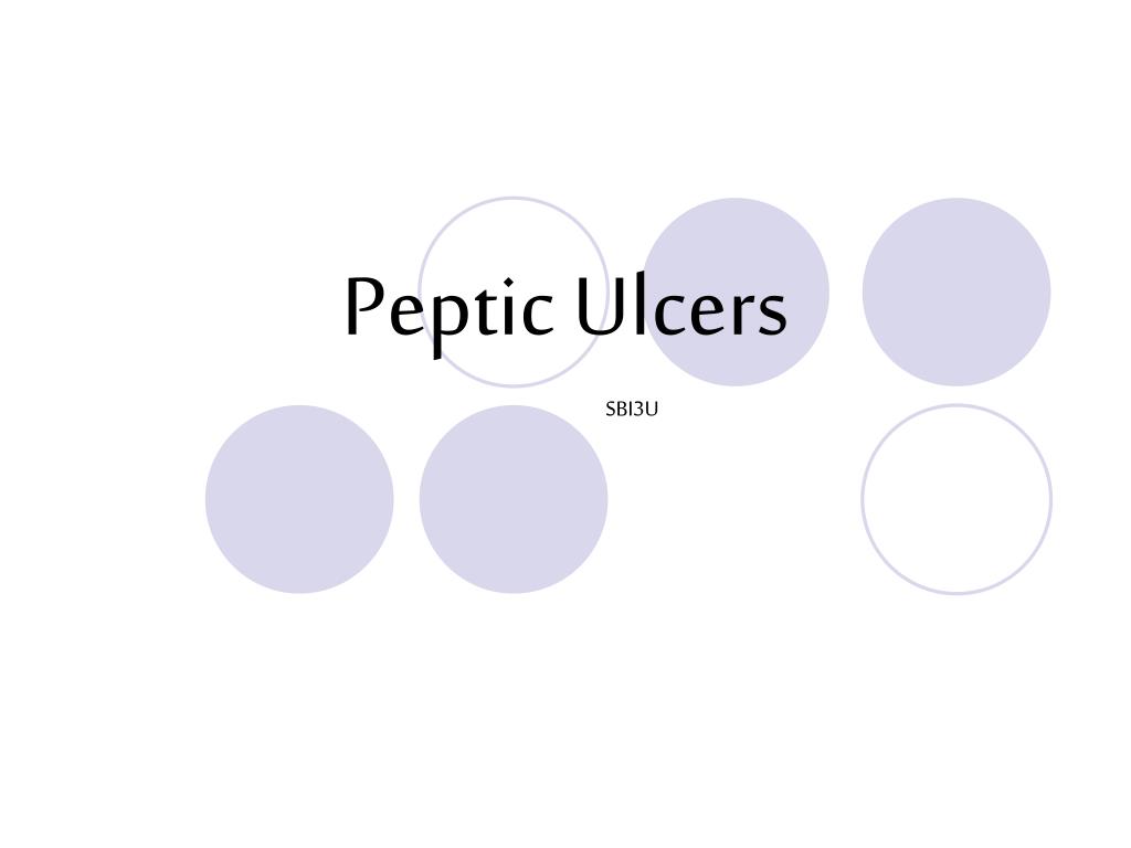 PPT - Peptic Ulcers PowerPoint Presentation, free download - ID:4899400
