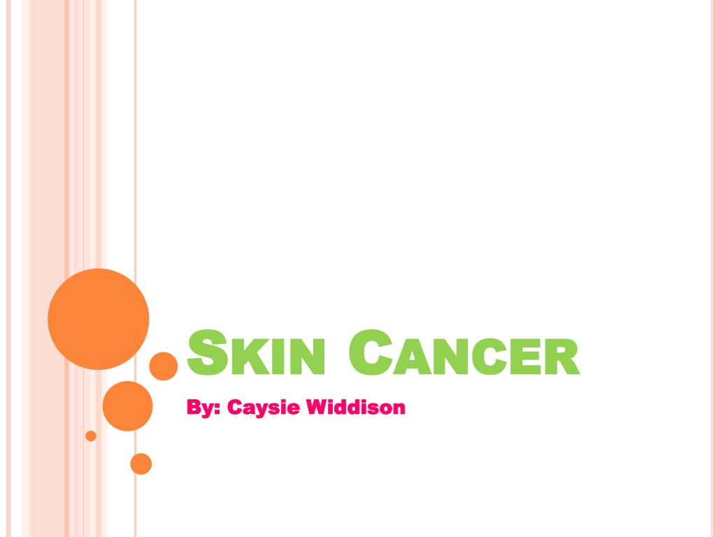 PPT - Skin Cancer PowerPoint Presentation, free download - ID:4946430