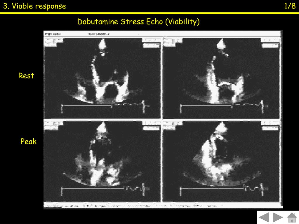 PPT - Rest PowerPoint Presentation, free download - ID:5012597