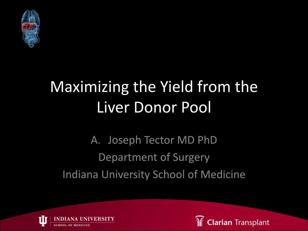 PPT - Maximizing the Yield from the Liver Donor Pool PowerPoint ...