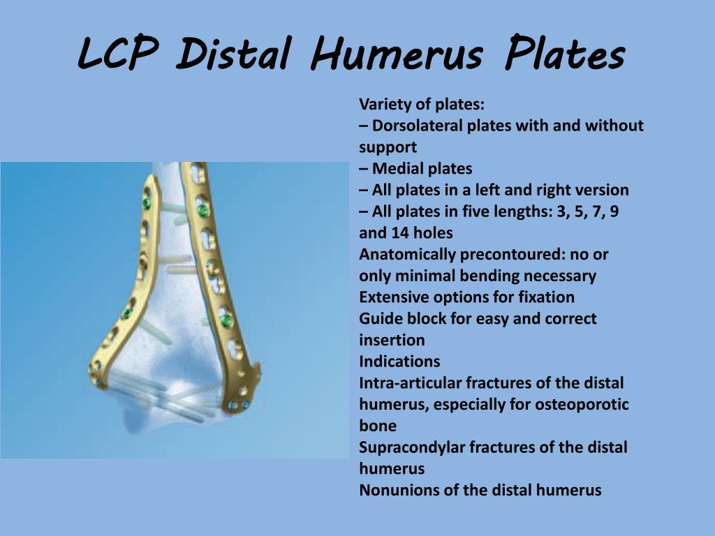 PPT - LCP Distal Humerus Plates PowerPoint Presentation, free download ...
