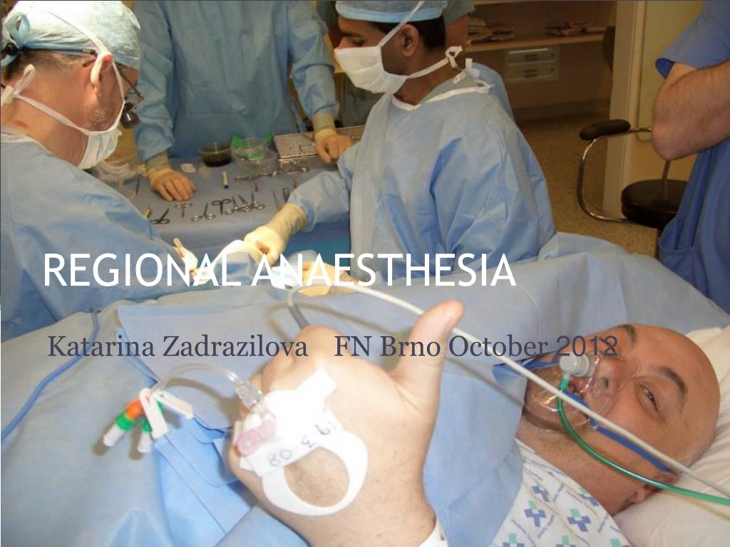 PPT - REGIONAL ANAESTHESIA PowerPoint Presentation, free download - ID ...