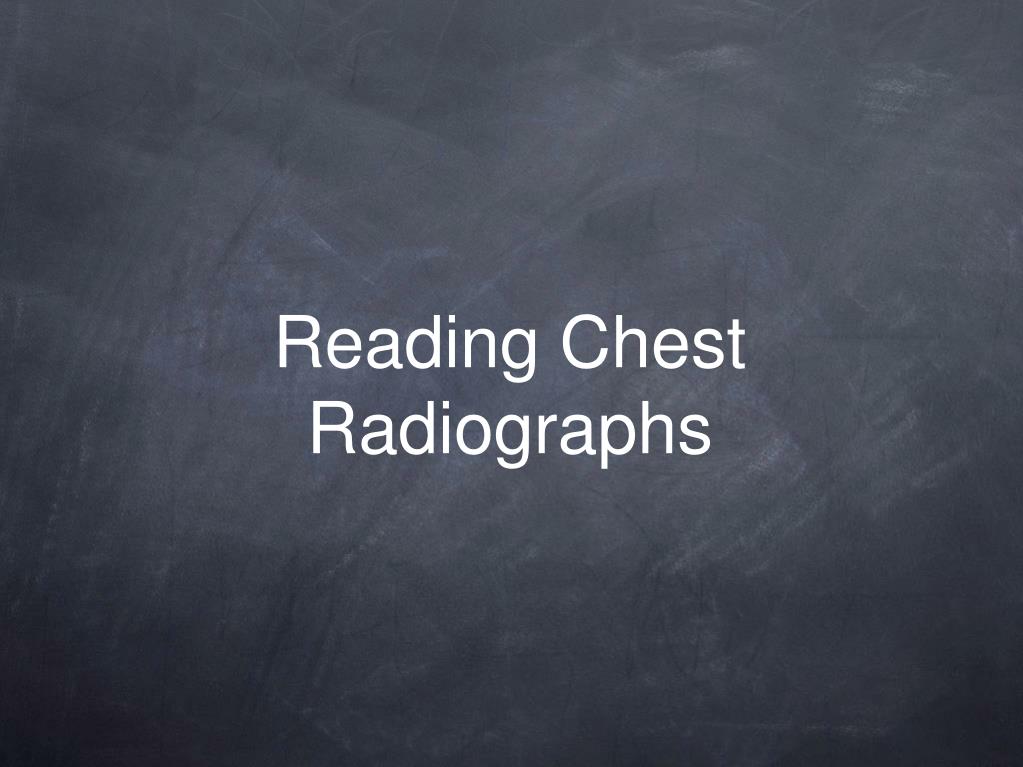 PPT - Reading Chest Radiographs PowerPoint Presentation, free download ...