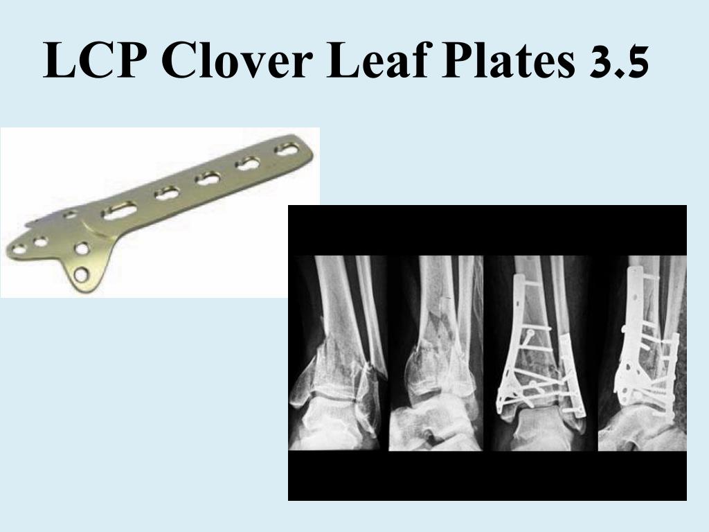 PPT - LCP Clover Leaf Plates 3.5 PowerPoint Presentation, free download ...