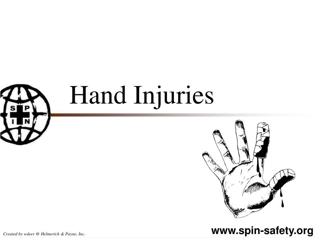 PPT - Hand Injuries PowerPoint Presentation, free download - ID:5324304