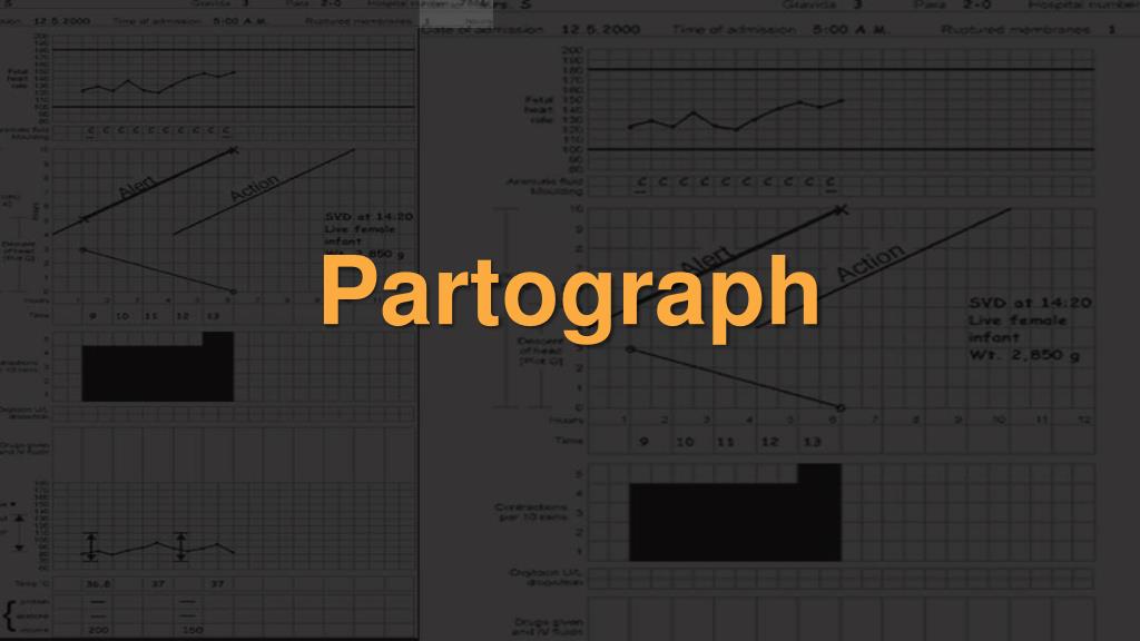 PPT - Partograph PowerPoint Presentation, free download - ID:5324995