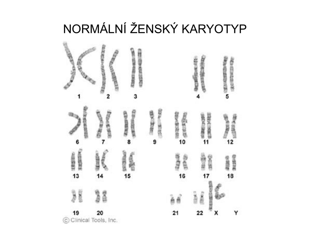 PPT - NORMÁLNÍ ŽENSKÝ KARYOTYP PowerPoint Presentation, free download ...