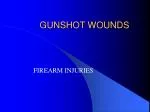PPT - FUNGATING WOUNDS PowerPoint Presentation, free download - ID:4236187