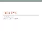 PPT - Red Eye PowerPoint Presentation, free download - ID:6983014